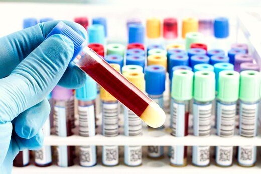 Sekiz Kanser Türü İçin Geliştirilen "CancerSEEK" Test Paneli Nasıl ...
