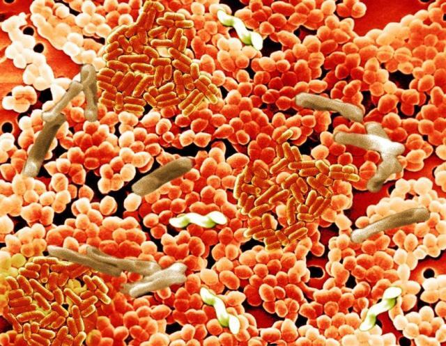 Clostridium Difficile Enfeksiyonu Hakkında Bilinmesi Gerekenler ...